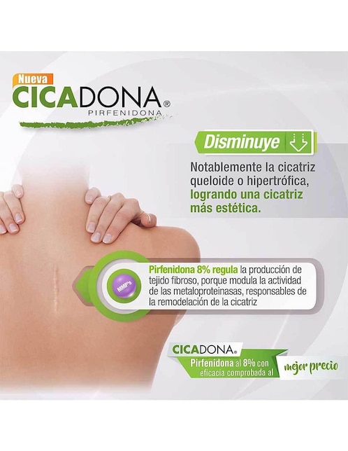 Crema Cicadona Pirfenidona 40 g | Liverpool.com.mx